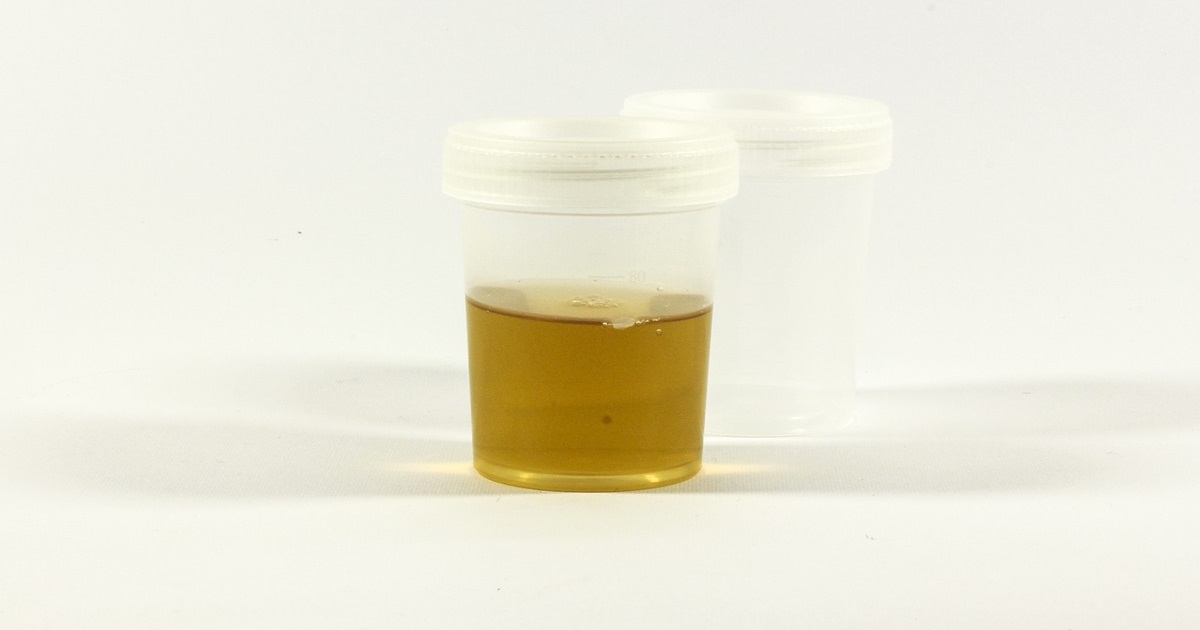 How Long Does Marijuana (THC) Stay in Your System?